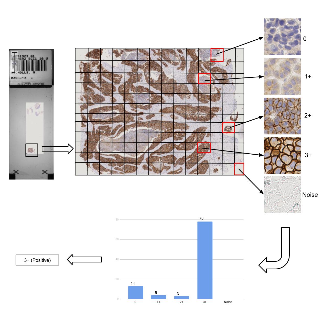 An Automatic Patch-based Approach for HER-2 Scoring in ...